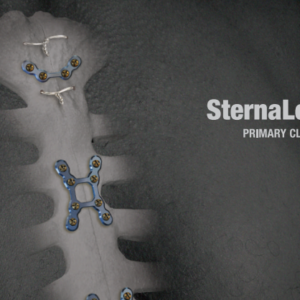 製品情報に関する記事一覧 – グンゼメディカル株式会社